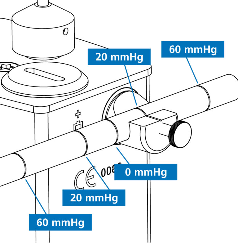 Goldmann tonometer calibration - Going for Goldmann